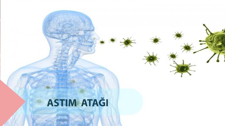 İprasal Nedir? Ne İşe Yarar? 2023 Fiyatı Ne Kadar?