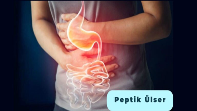 Rabelis 20 mg Ne İçin Kullanılır? Nasıl Kullanılır?